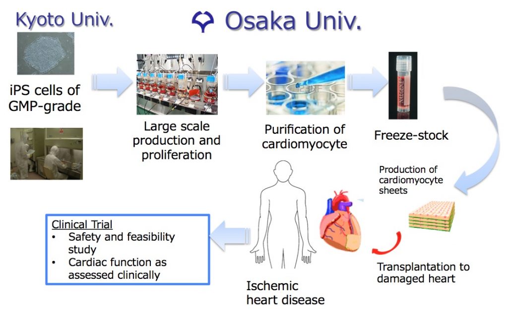 iPS cell-based therapy for heart disease: clinical application iPS cell ...