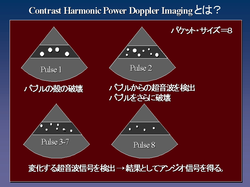 Contrast Harmonic Power Doppler Imaging とは？