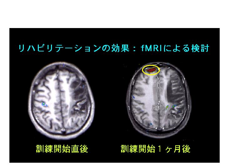 Welcome to Brain Group