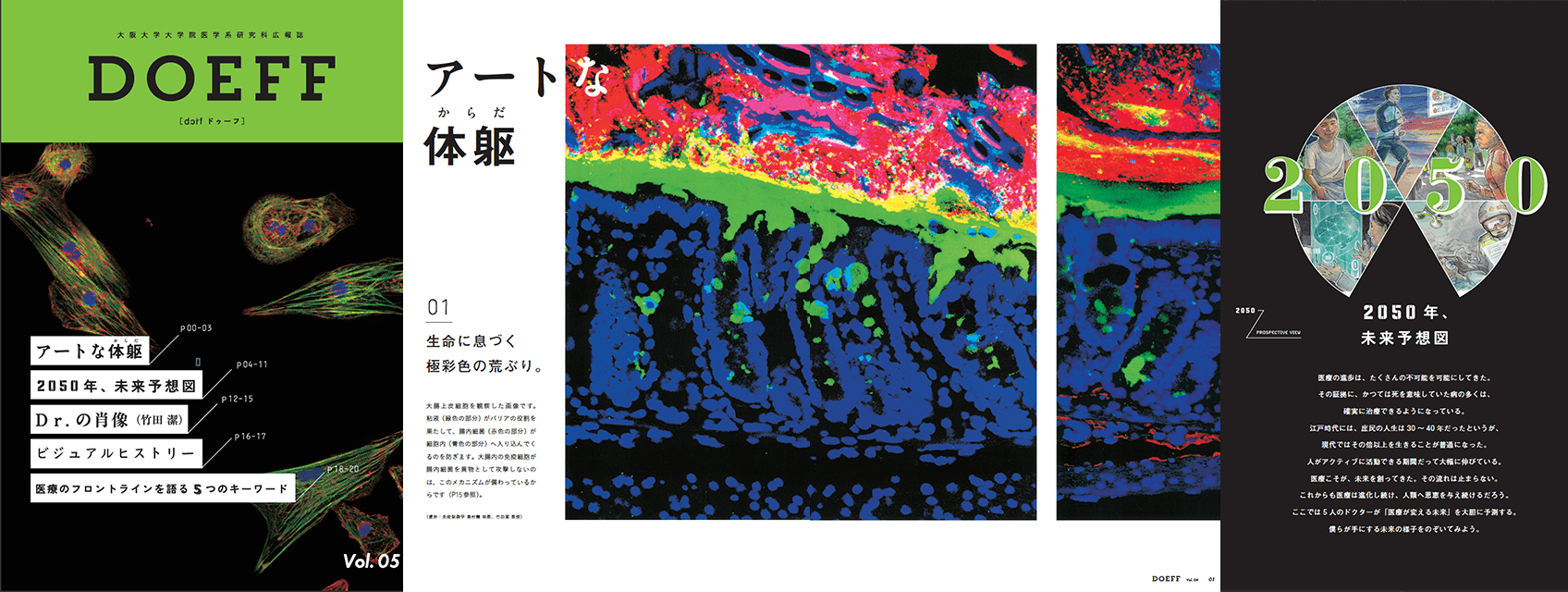 広報誌｢DOEFF(ドゥーフ)｣ | 大阪大学医学系研究科・医学部